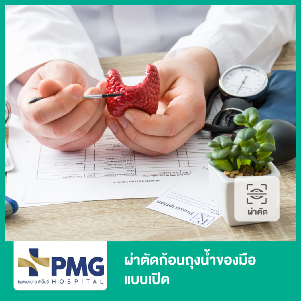 ผ่าตัดก้อนถุงน้ำของมือ แบบเปิด ที่ PMG Hospital - ราคา 2567 (2024) | HDmall