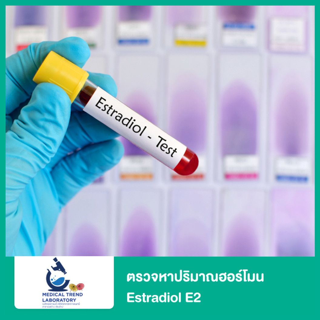 ตรวจหาปริมาณฮอร์โมน Estradiol E2 ที่ Medical Trend Clinic Lab - ราคา ...