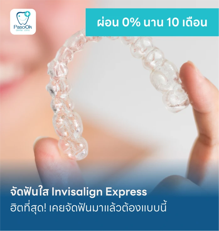 จัดฟันใส Invisalign Express - ราคา 2568 (2025) | HDmall
