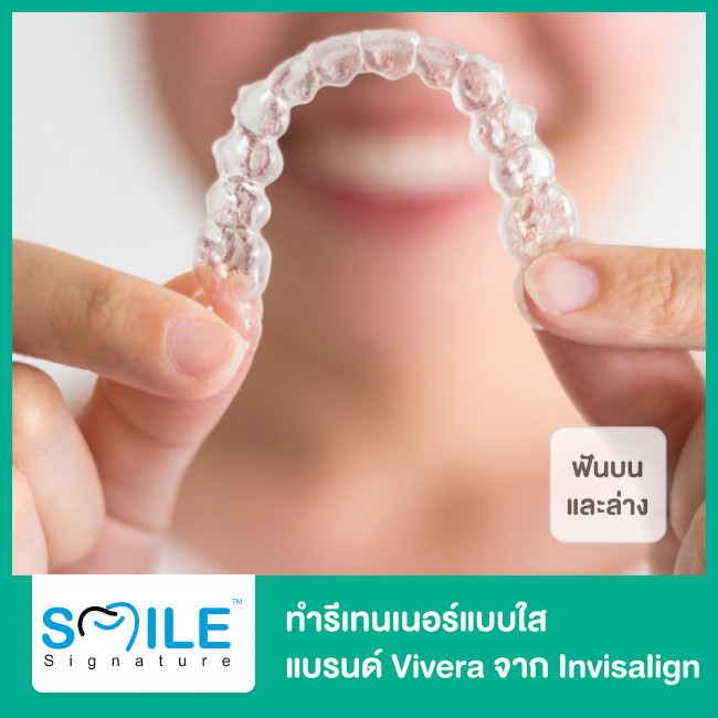 ทำรีเทนเนอร์แบบใส แบรนด์ Vivera จาก Invisalign ฟันบนและล่าง ที่ Smile ...