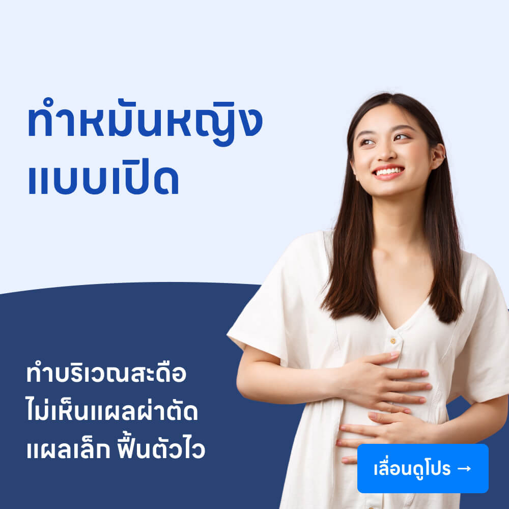 ทำหมันหญิงแบบเปิด - ราคา 2568 (2025) | HDmall